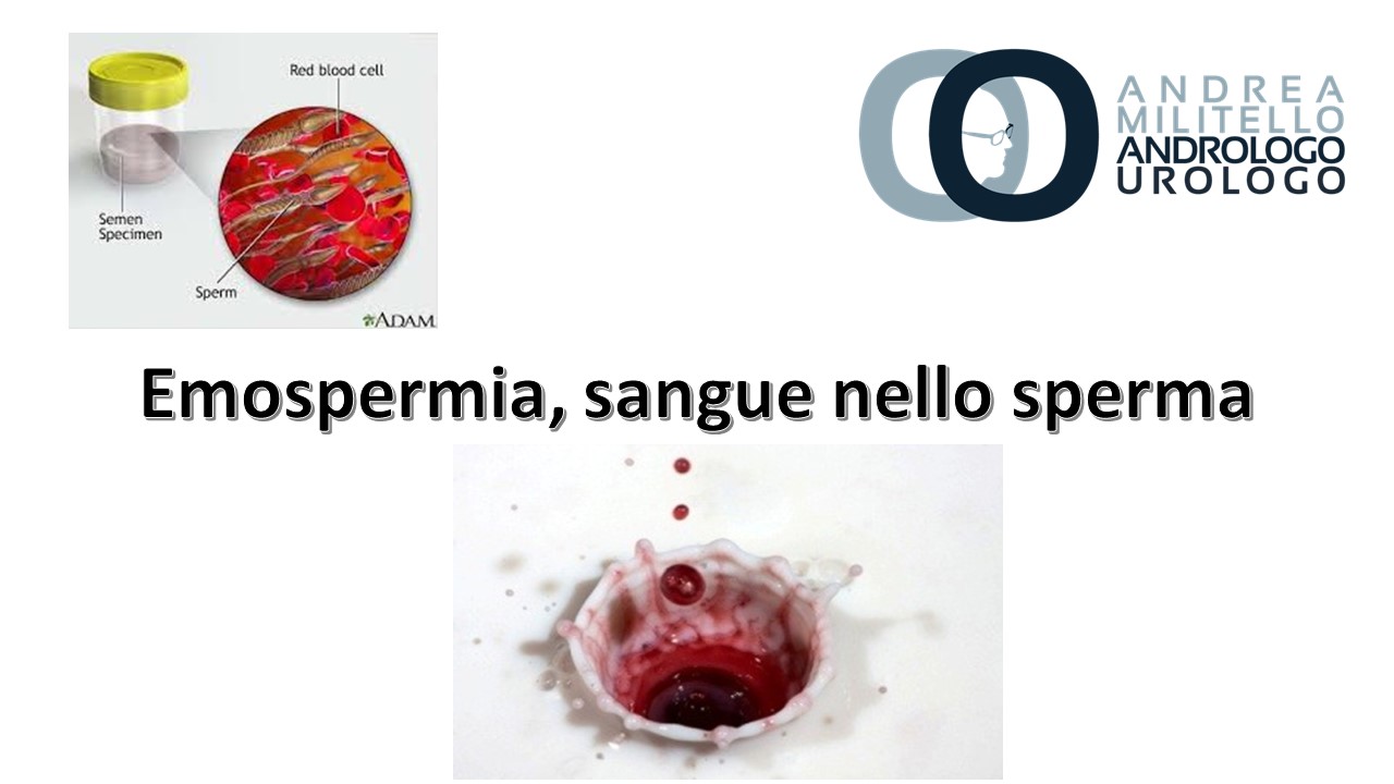 Emospermia: Sangue nello sperma - Andrologia Militello